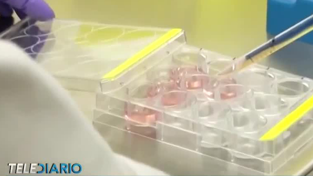 Conozca qué es Prep el medicamento que se utiliza para prevenir VIH ...